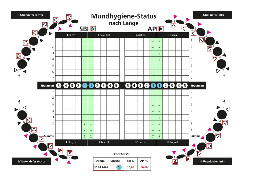API SBI Grafik - Recall Magazin